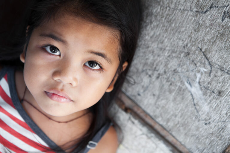 Dancing Eye Syndrome | OMAS | Repeated Eye Movement